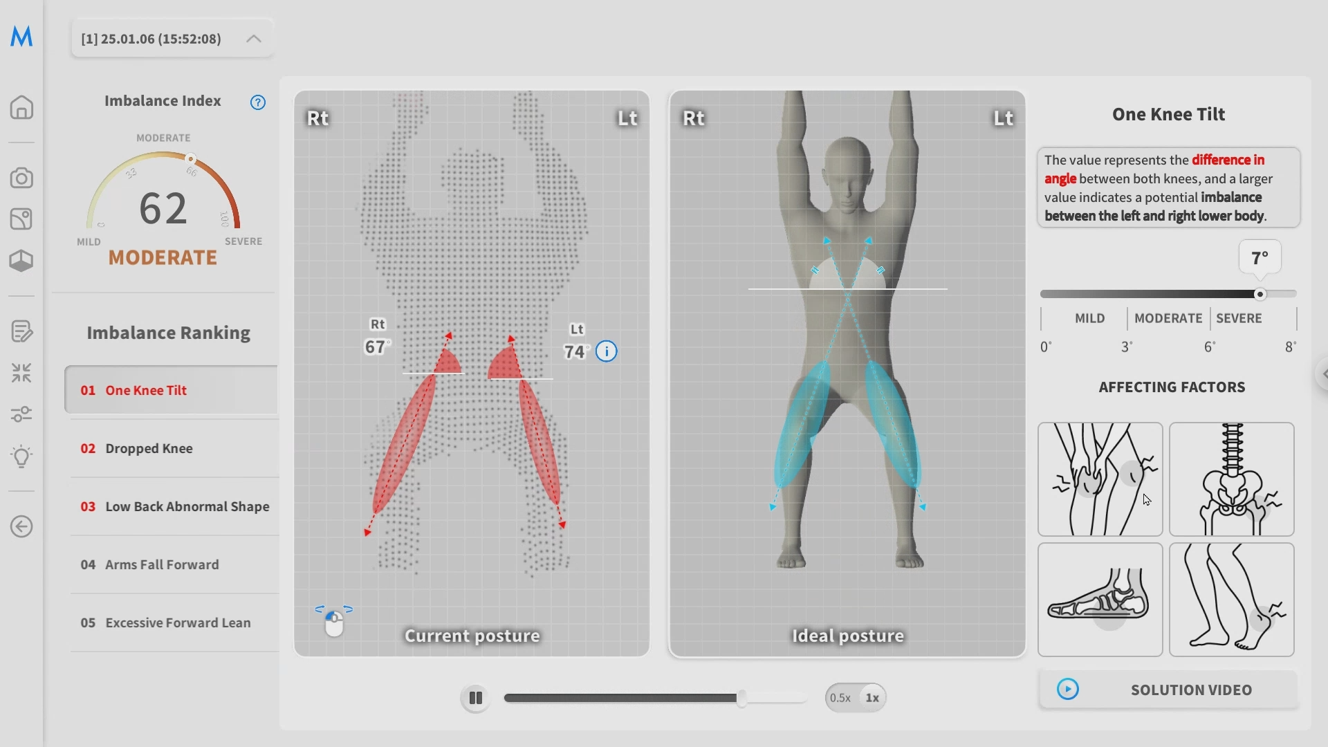 ORTOMECANICA - Moti Physio - PROMOCIÓN