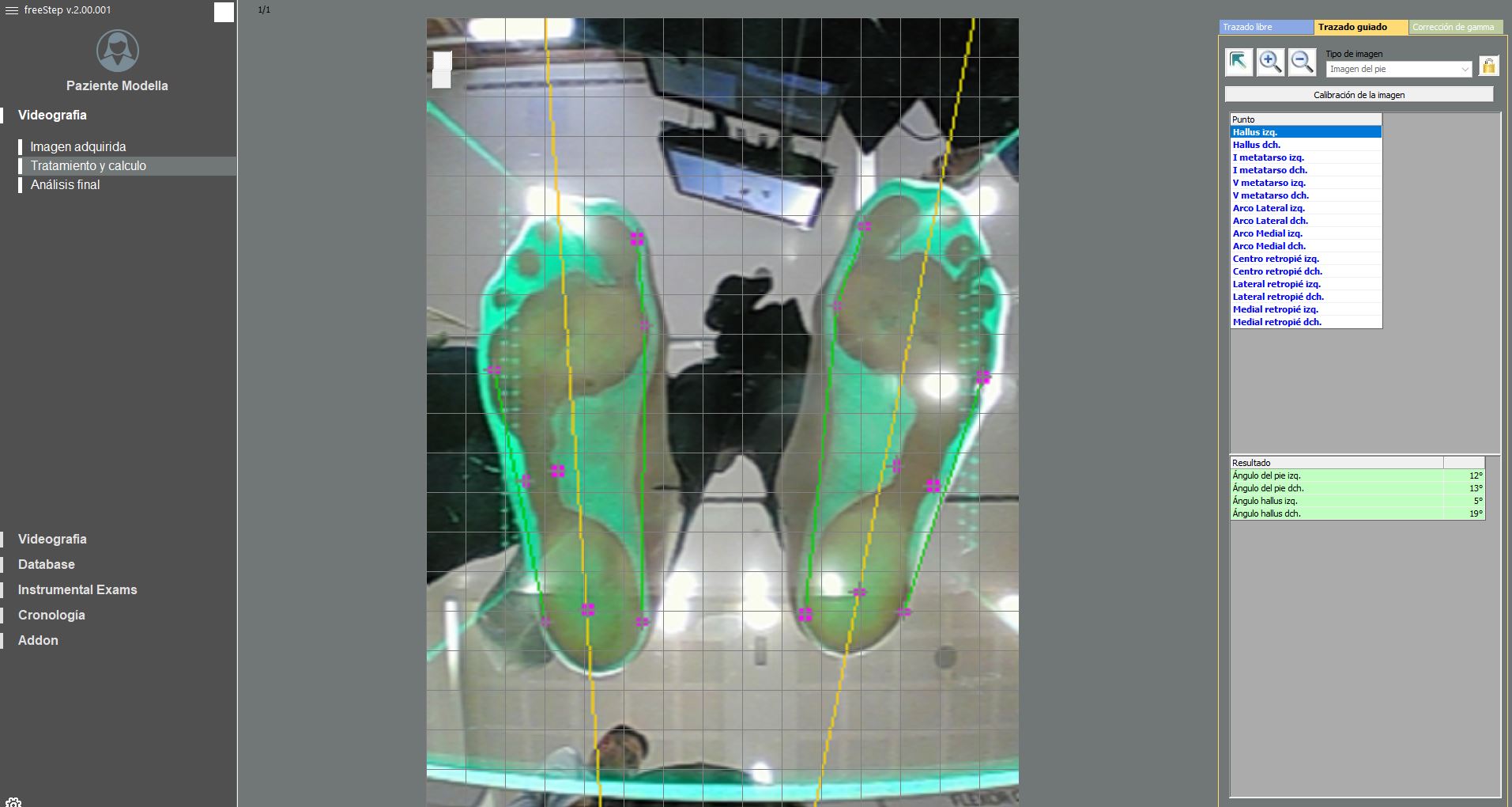 ORTOMECANICA - Podoscopio Digital LED y cámara HD