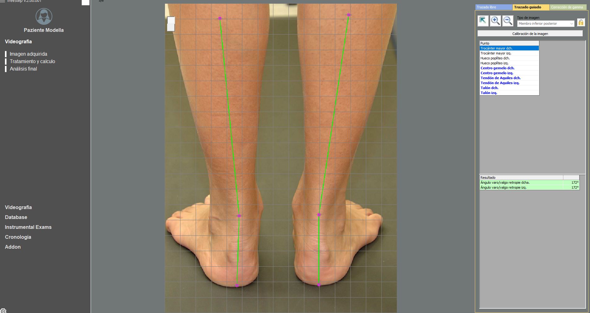 ORTOMECANICA - Podoscopio Digital LED y cámara HD